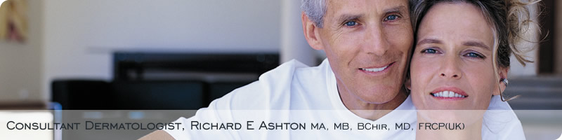 Richard Ashton Dermalogical Surgeon | Check your own mole, melanoma, skin cancer check